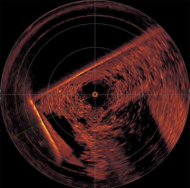 Scanning Sonars Tritech Seaprince